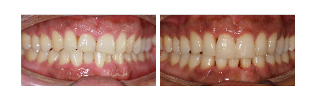 Roadmap to a beautiful, healthy smile - Maidstone Dental