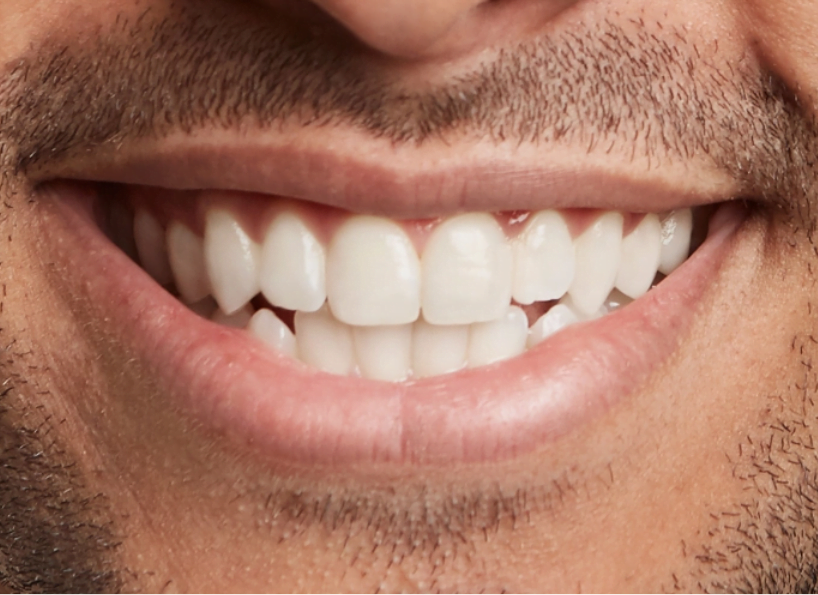 Roadmap to a beautiful, healthy smile - Maidstone Dental