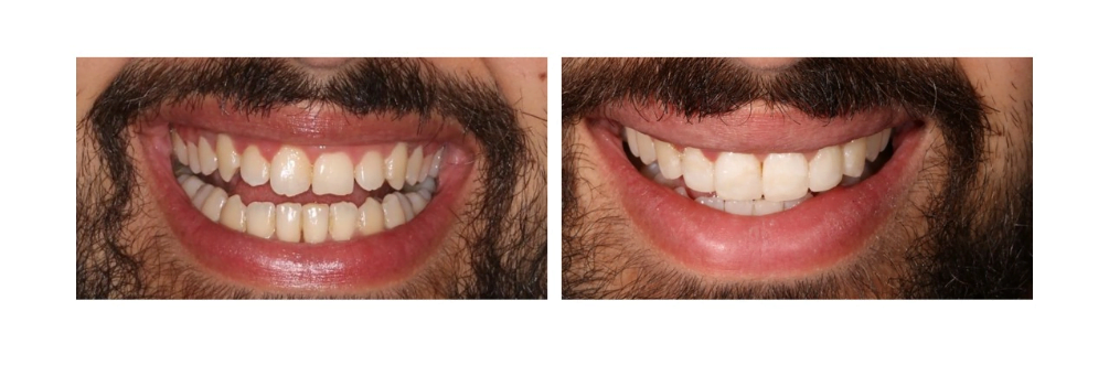 Roadmap to a beautiful, healthy smile - Maidstone Dental